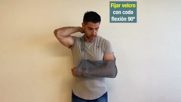 Guía paso a paso: Cómo poner un cabestrillo para fractura de húmero ...